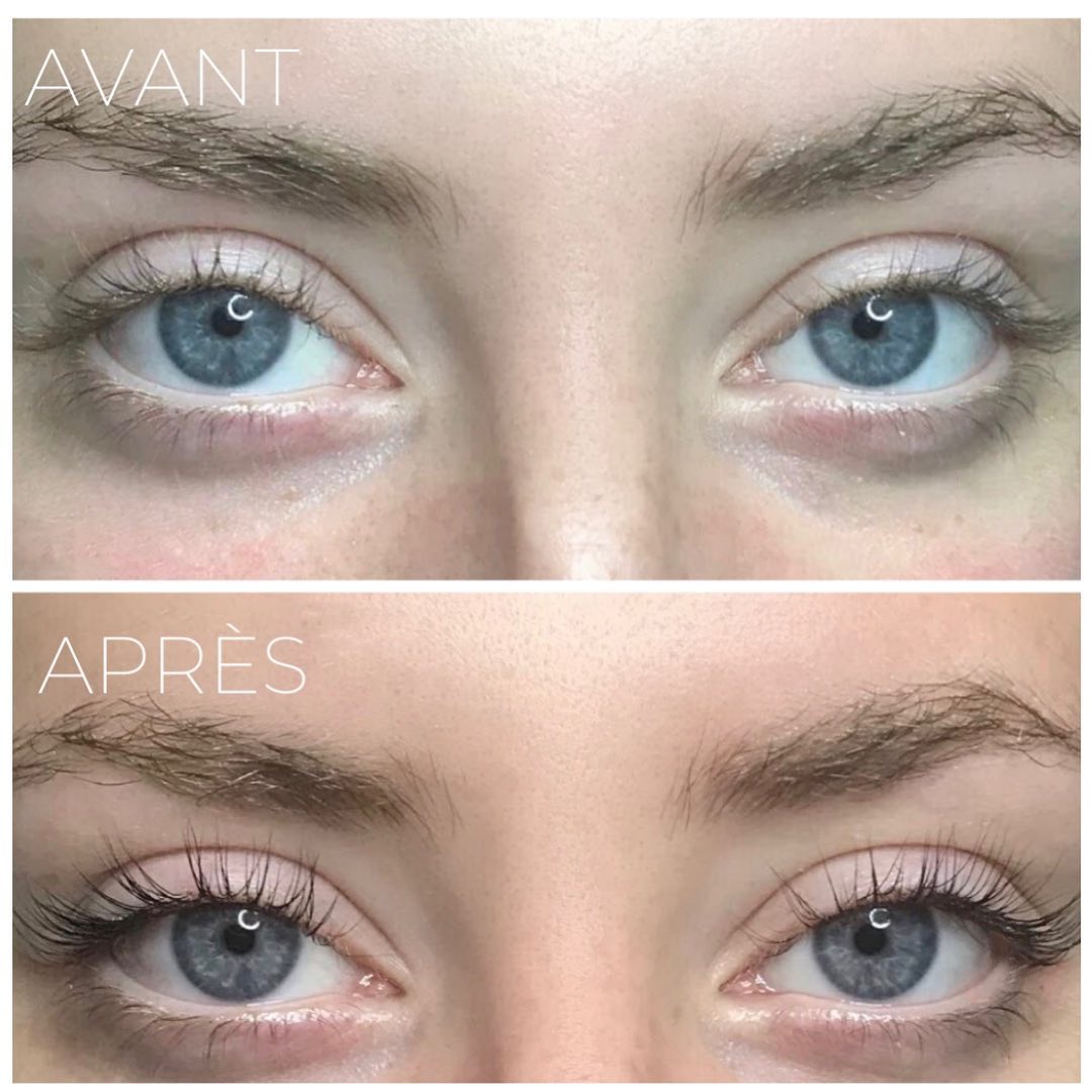 Notre blog ~ Institut de beauté Chrysalide - Votre Institut Beauté à Oloron Sainte Marie